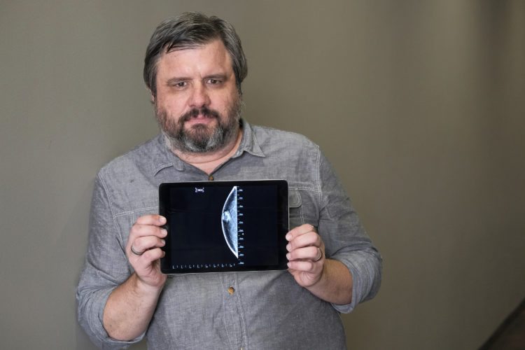 Man Describes Mammogram Experience | News, Sports, Jobs - The Intelligencer